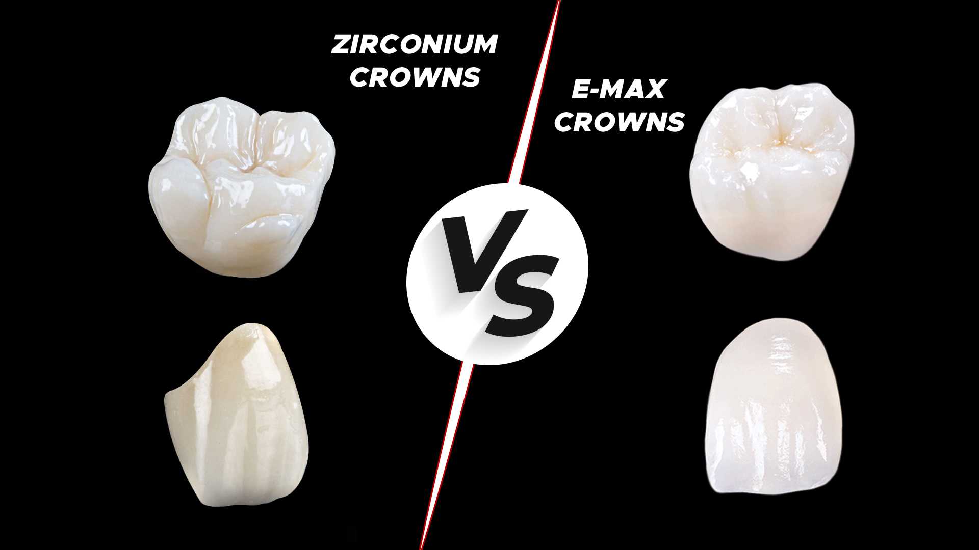 Zirconium Crown Zirconium Crown